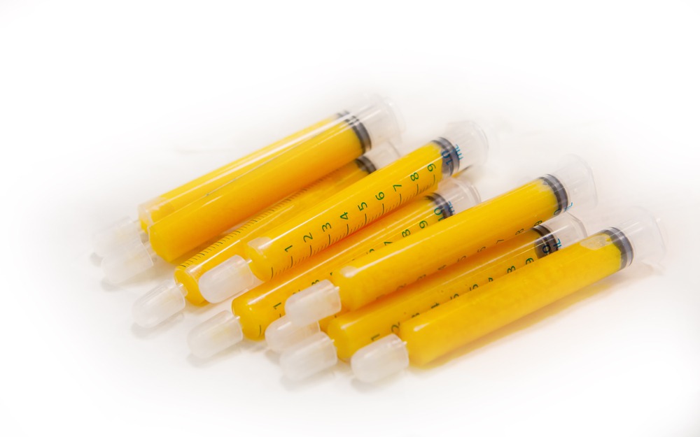 Nanofat grafting : les injections d'éternelle jeunesse