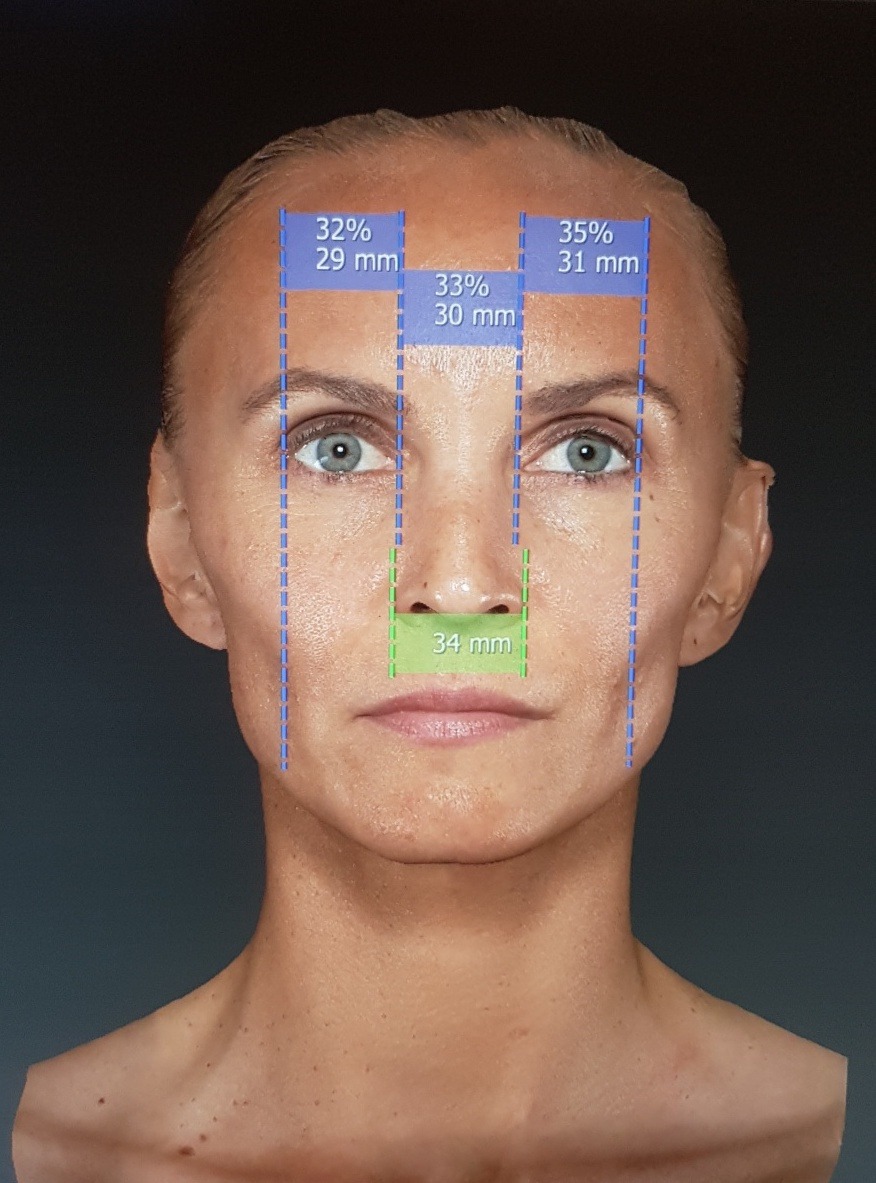 Savez-vous pourquoi votre visage est asymétrique